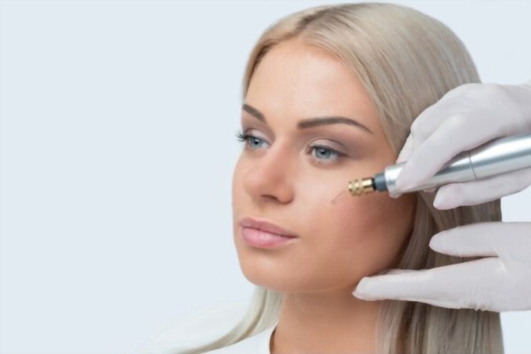 Plasma Fibroblast – Derma Pro Skin & Aesthetic Clinic